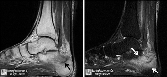 Learningradiology